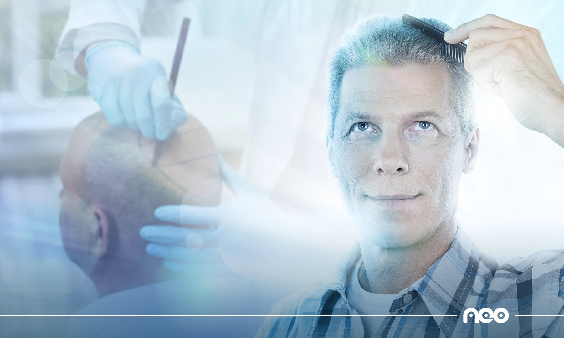 Recovery After Hair Transplant in Turkey: What to Expect? - Neo Hair ...