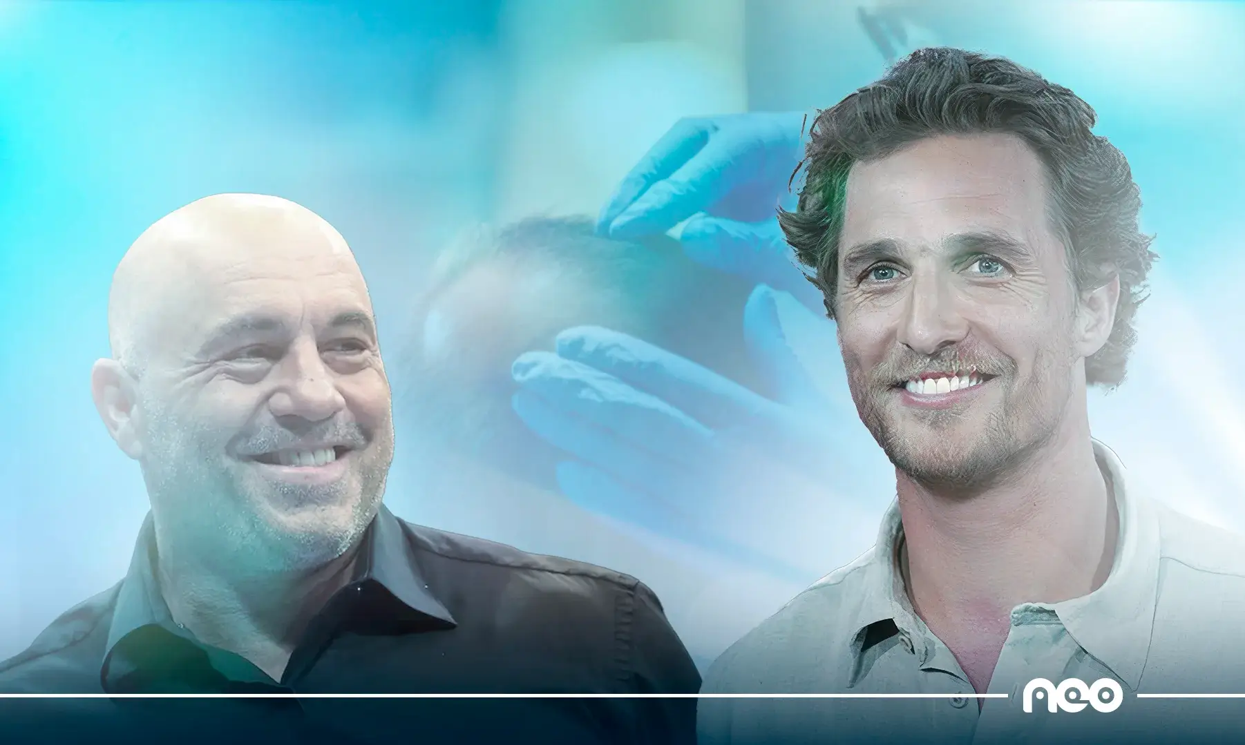 Joe Rogan Hair Transplant and Matthew McConaughey Hair Transplant ...
